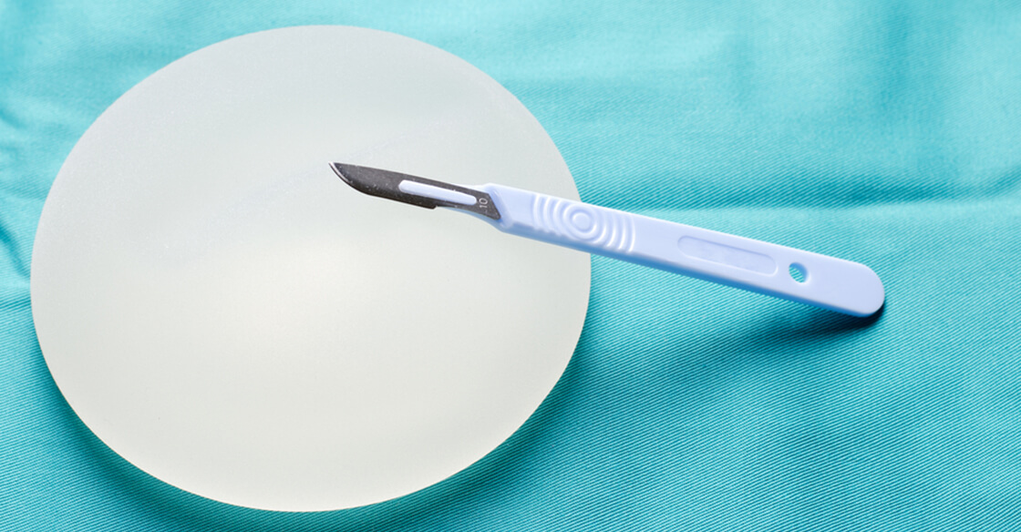 Silicone Body Implants and Cryotherapy | San Diego Cryotherapy